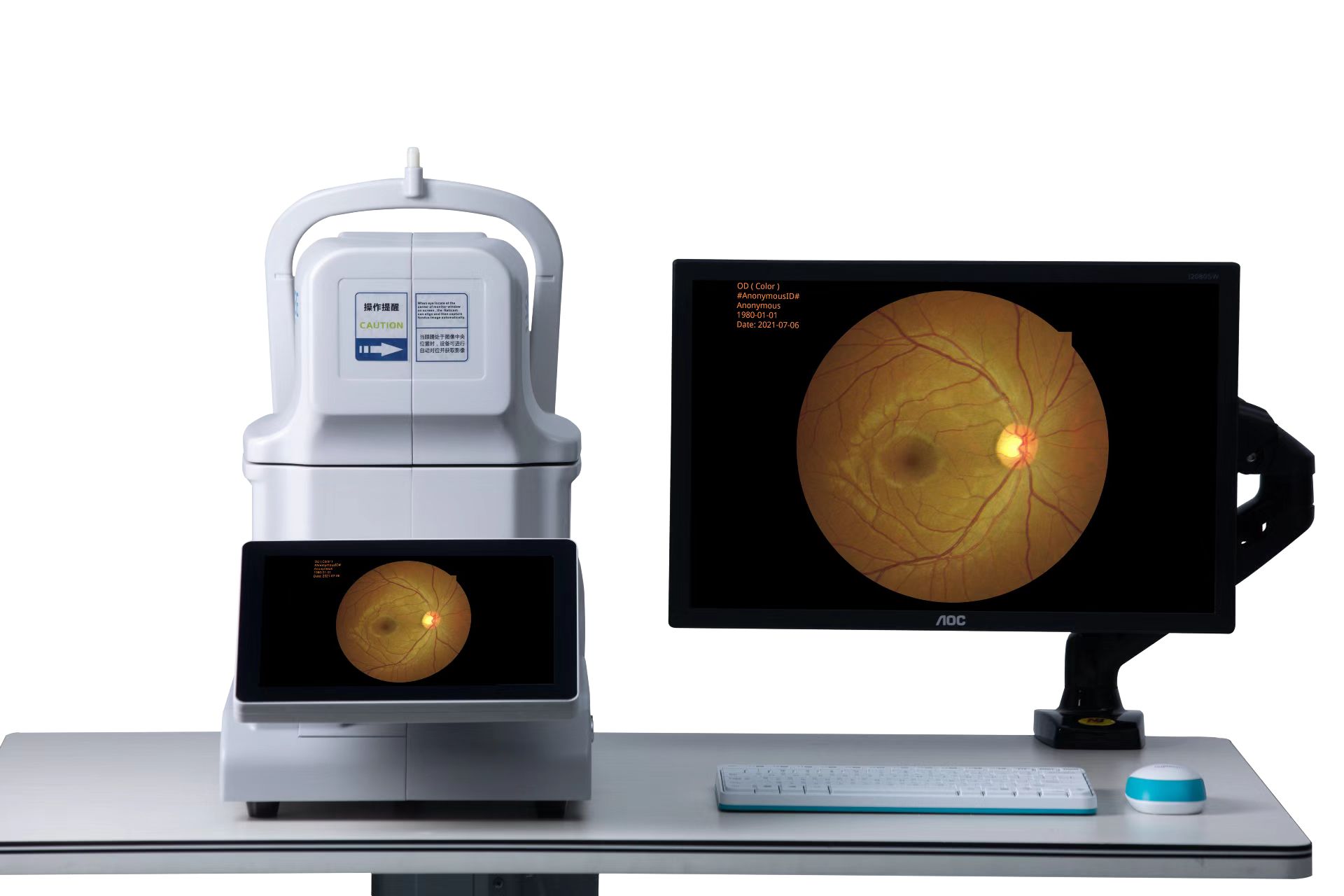 Non Mydriatic Fundus Camera Beijing Enoch Corporation